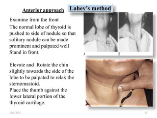 ultimate to upload updated on 14september 2022 Thyroid examination.pptx