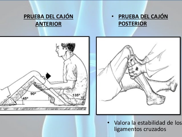RODILLA