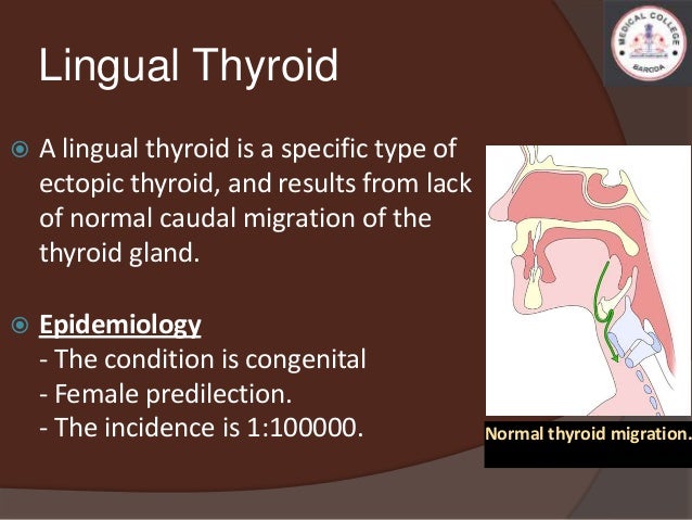 Thyroid Symptoms Tongue