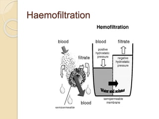 Ultrafiltration | PPTX