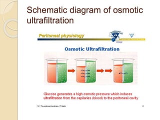 Ultrafiltration | PPTX