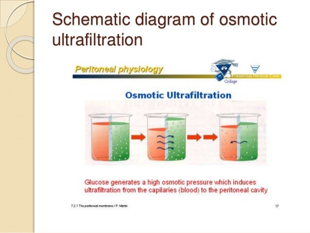 Ultrafiltration
