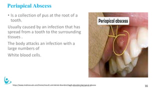 Ultramox - Ceforan New Campaigns presentation.pptx