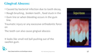 Ultramox - Ceforan New Campaigns presentation.pptx