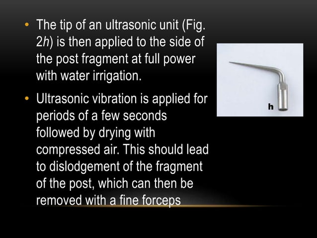 Ultrasonics in endodontics | PPTX | Dental Health | Diseases and Conditions