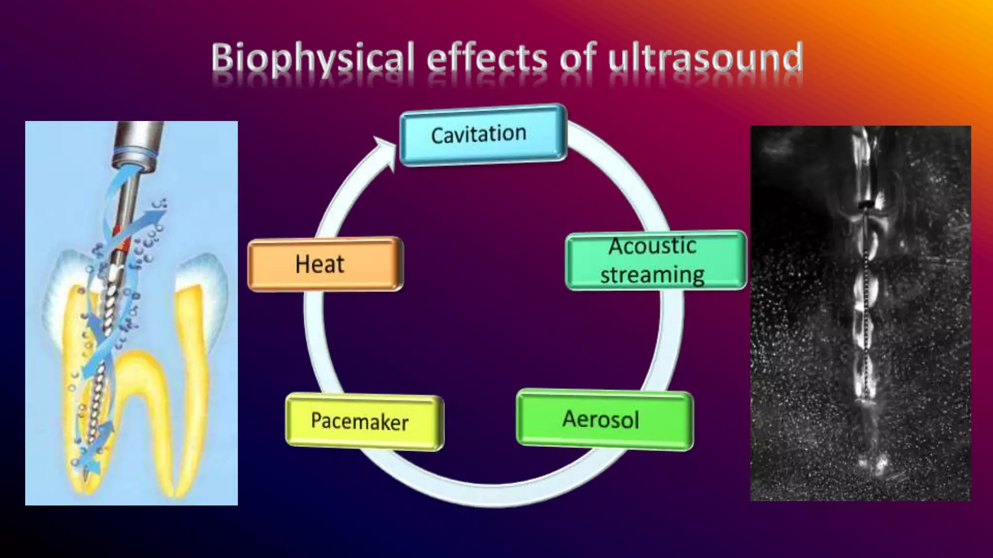 Ultrasonics in Endodontics.pptx