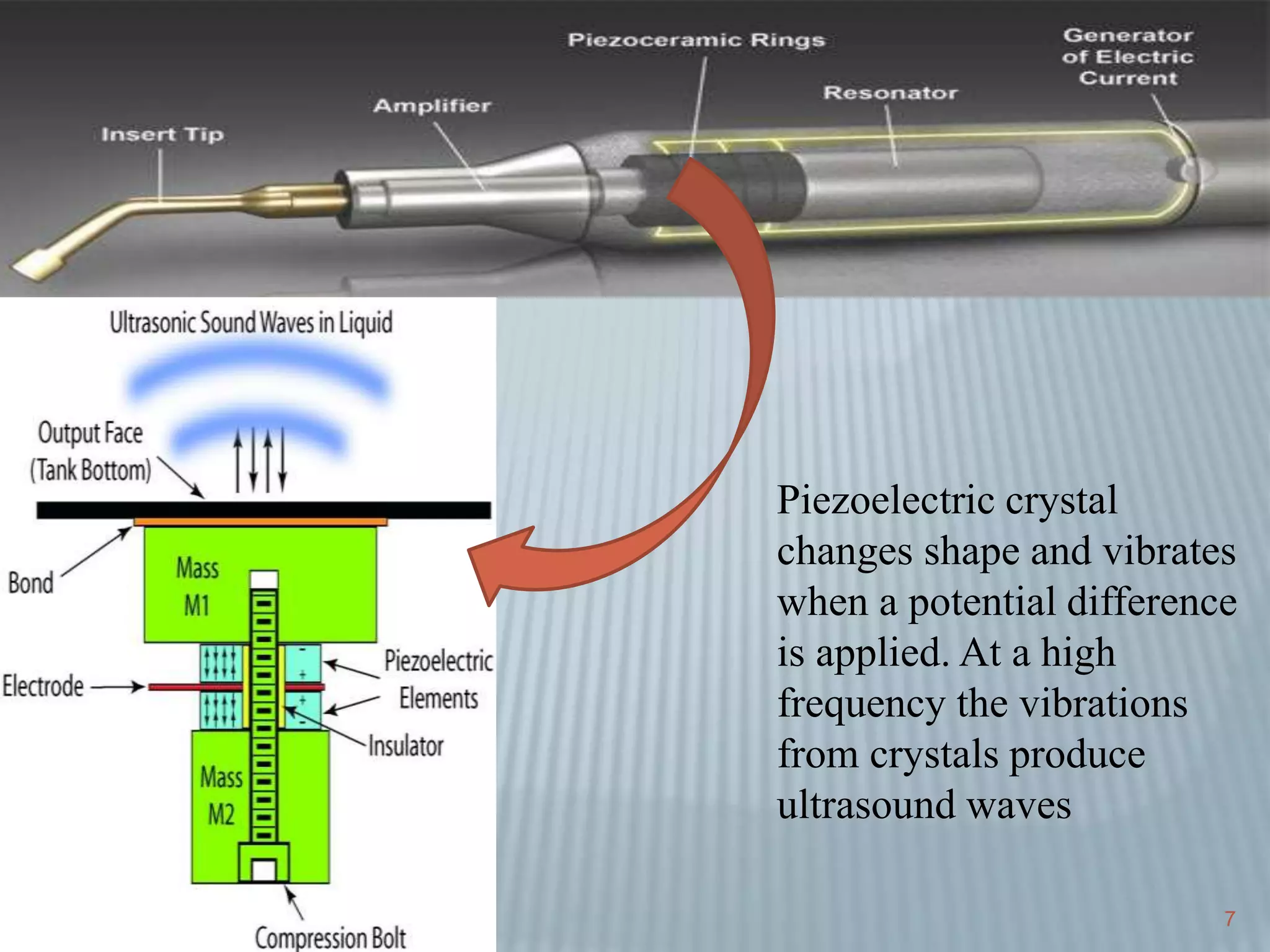Ultrasonics endodontic tips | PPTX