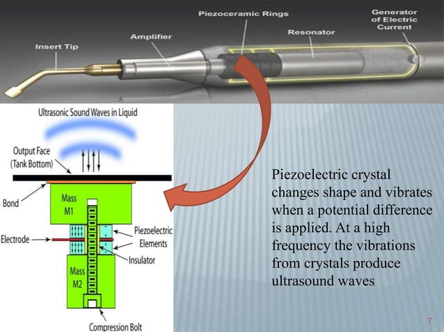 Ultrasonics endodontic tips | PPTX | Dental Health | Diseases and ...