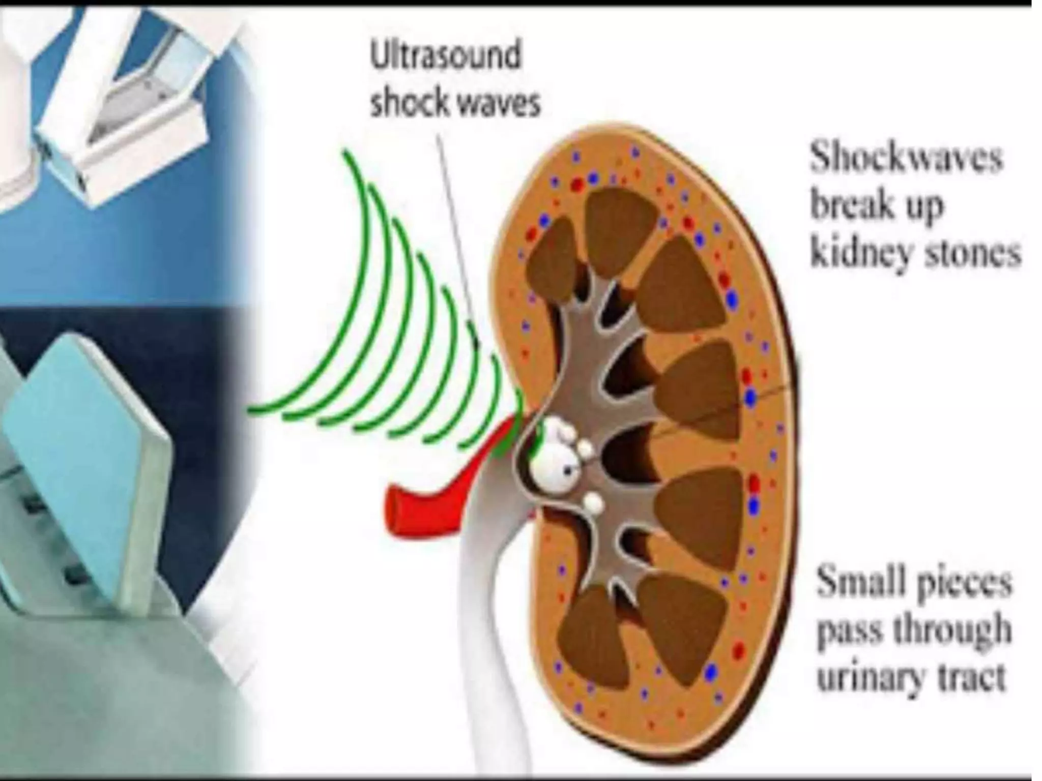 ultrasonic waves.pptx