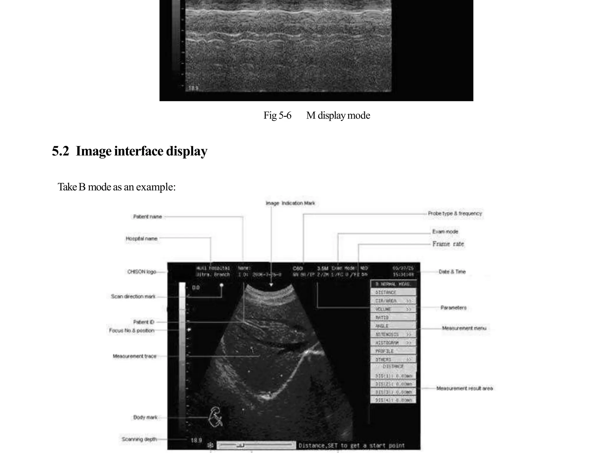 ultrasonido manual para usar ultrasonido chison powerpoint 600m.ppt