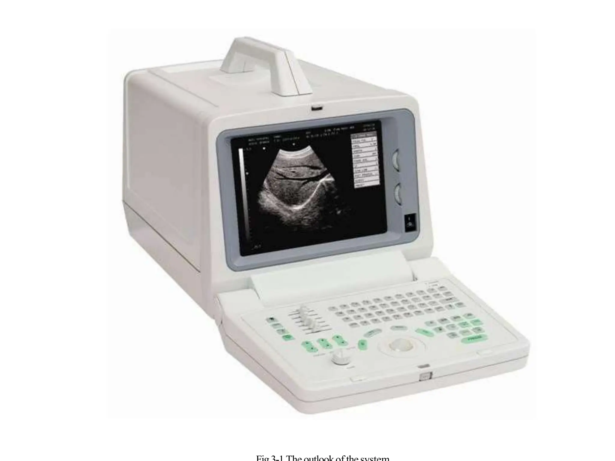 ultrasonido manual para usar ultrasonido chison powerpoint 600m.ppt