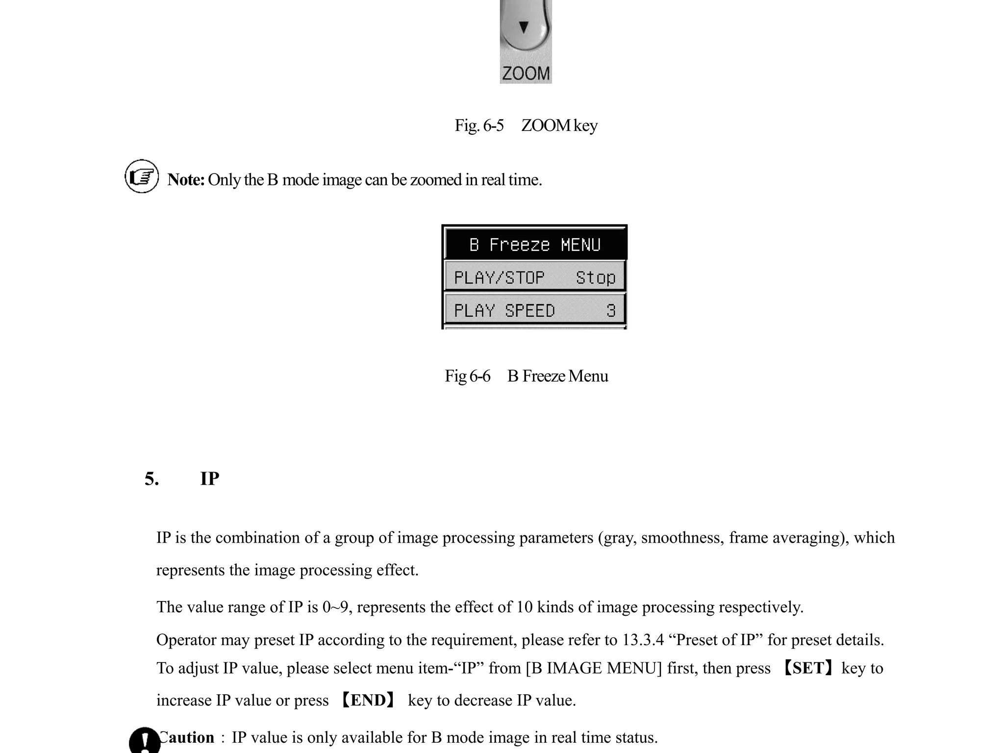 ultrasonido manual para usar ultrasonido chison powerpoint 600m.ppt