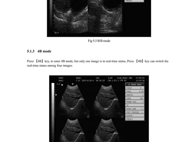 ultrasonido manual para usar ultrasonido chison powerpoint 600m.ppt
