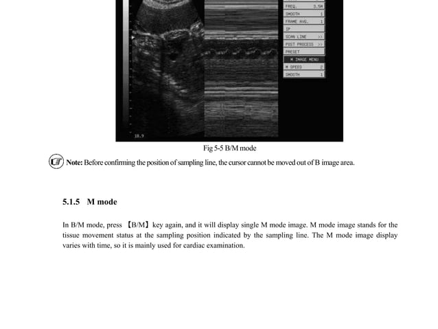 ultrasonido manual para usar ultrasonido chison powerpoint 600m.ppt
