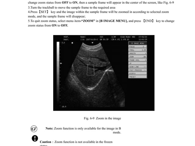 ultrasonido manual para usar ultrasonido chison powerpoint 600m.ppt
