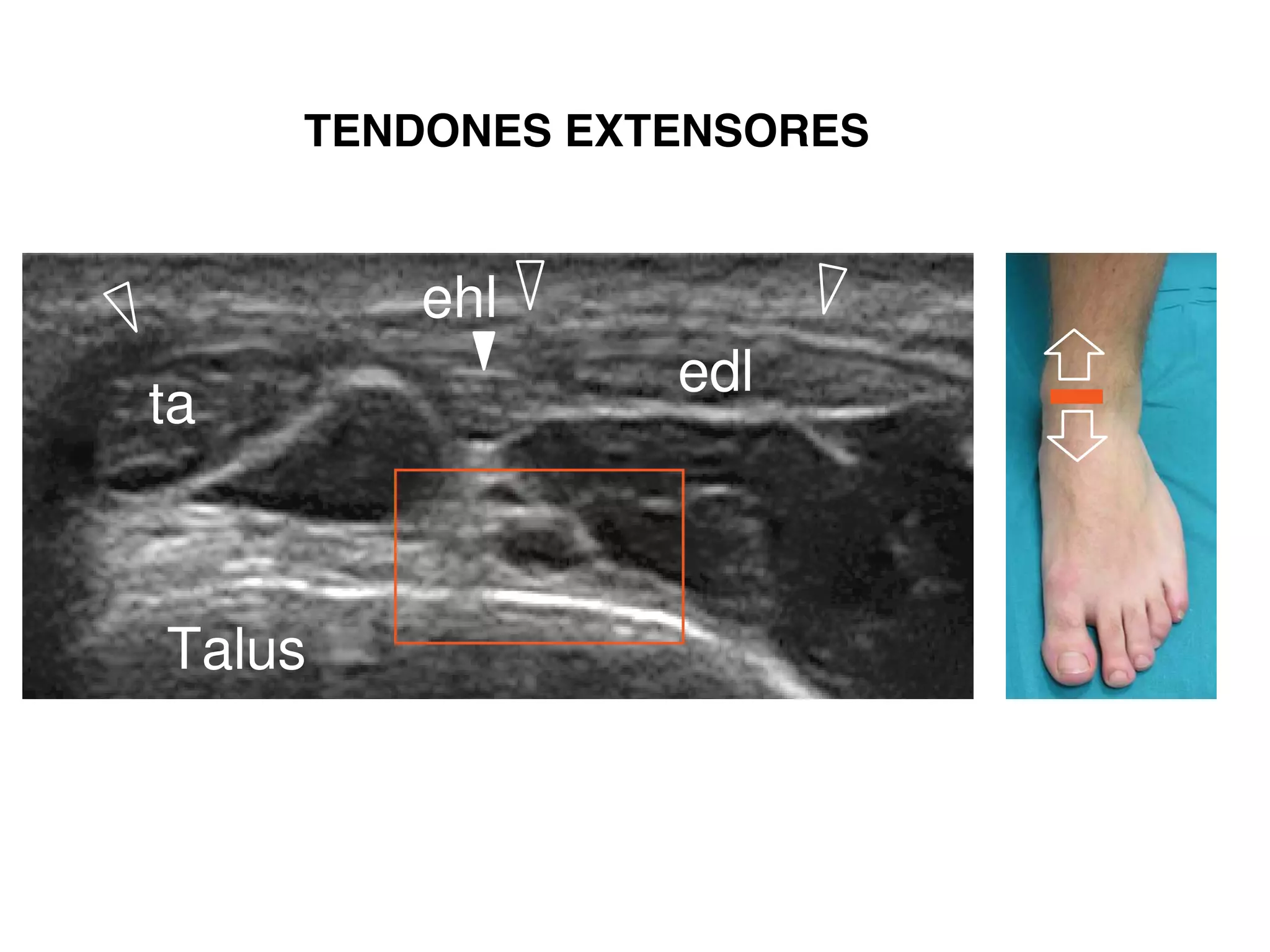 Ultrasonido de tobillo anatomía | PDF