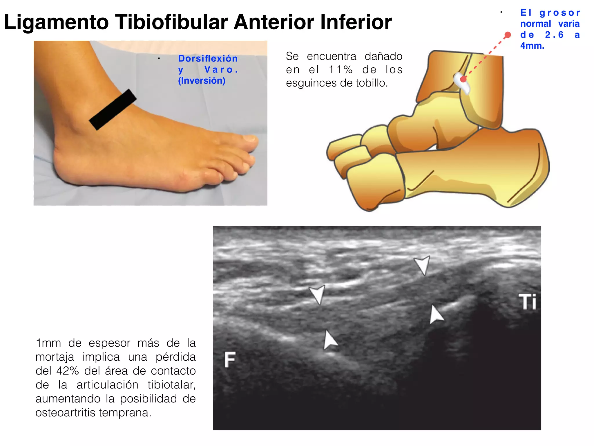 Ultrasonido de tobillo anatomía | PDF