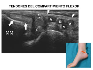 Ultrasonido de tobillo anatomía | PDF
