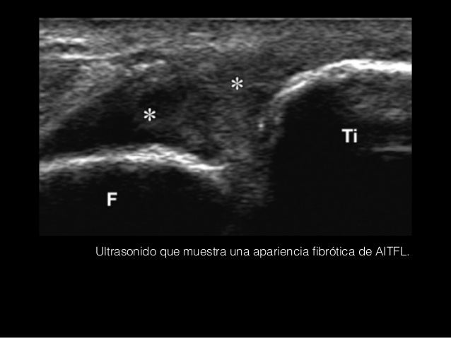 Ultrasonido De Tobillo Anatomía