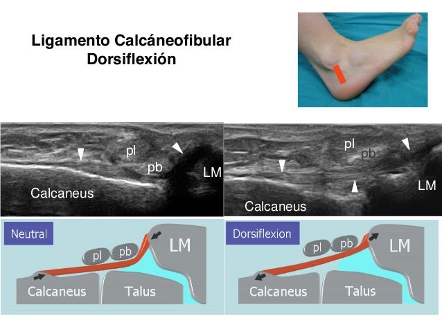 Ultrasonido de tobillo anatomía
