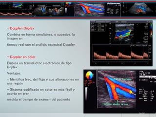Ultrasonido doppler | PPTX