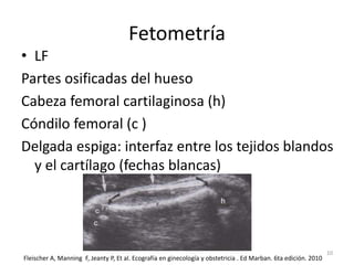 Ultrasonido estructural | PPTX