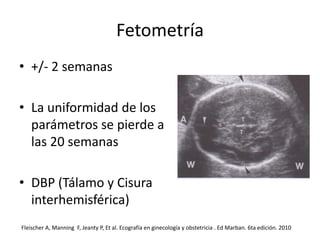 Ultrasonido estructural | PPTX