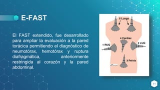 Ultrasonido fast | PPTX