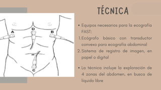 Ultrasonido FAST en trauma.pdf