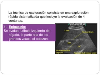 Ultrasonido FAST en Trauma | PPTX