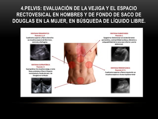 ULTRASONIDO FAST (FOCUSED ABDOMINAL SONOGRAPHY FOR TRAUMA.pptx
