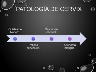 Ultrasonido De Pólipos Cervicales