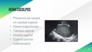 ULTRASONIDO PELVICO.pptx