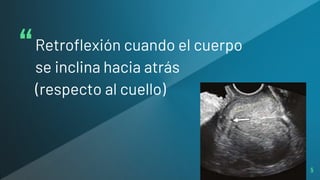 ULTRASONIDO PELVICO.pptx