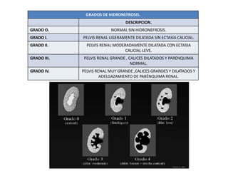 Ultrasonido valores | PPTX