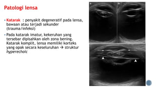Ultrasonografi Okular yang Difokuskan pada Segmen Posterior Mata.pptx