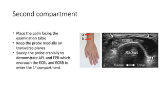 Ultrasonographic evaluation wrist joints | PPTX
