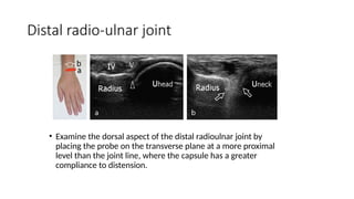 Ultrasonographic evaluation wrist joints | PPTX