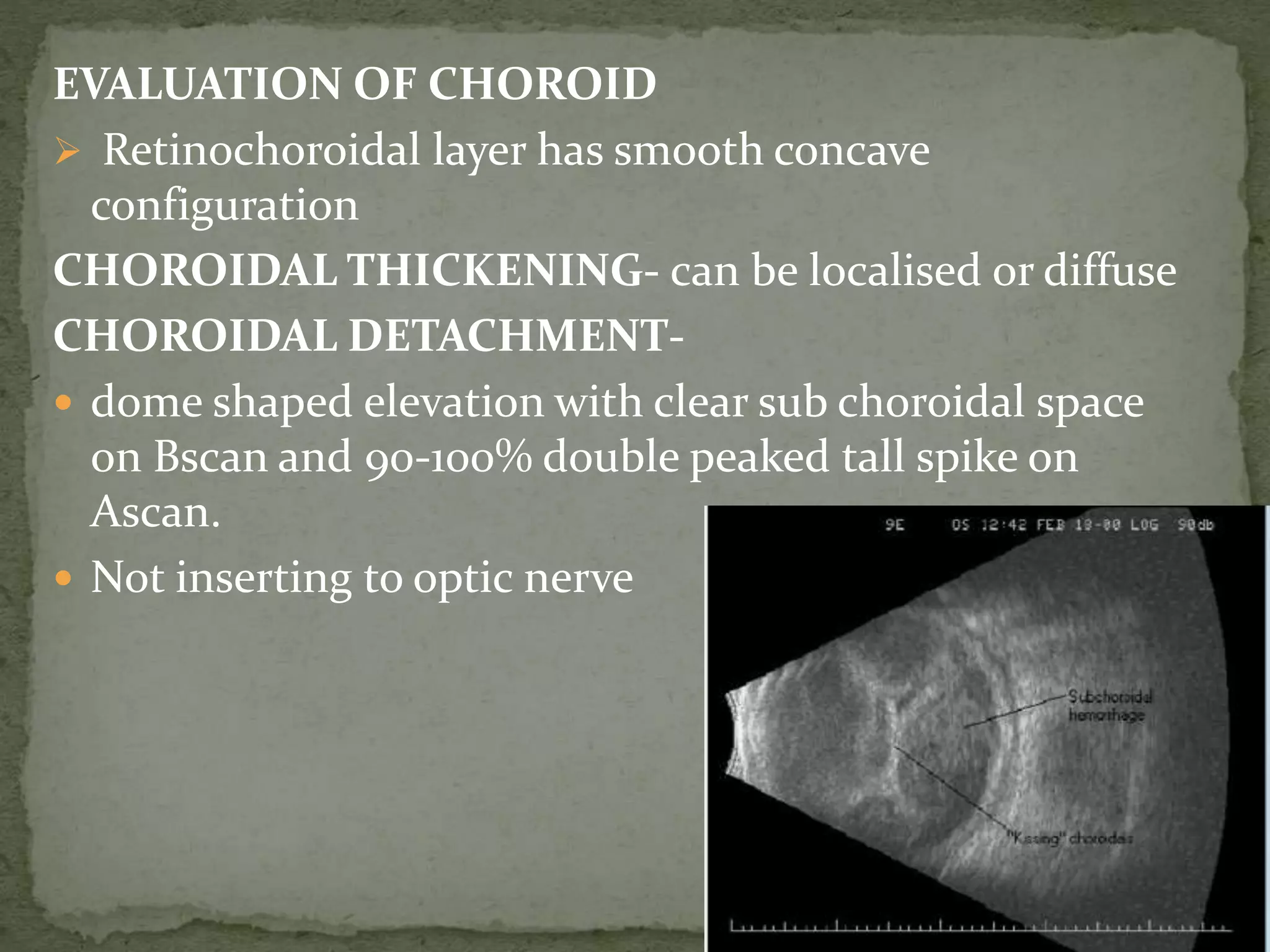 Ultrasonography in ophthalmology | PPTX
