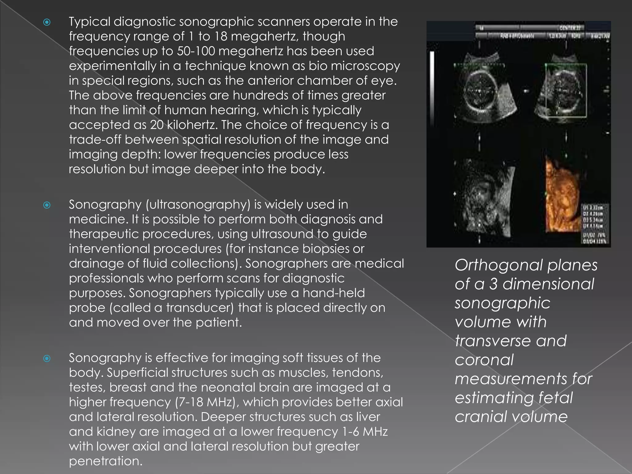 Ultrasonography | PPTX