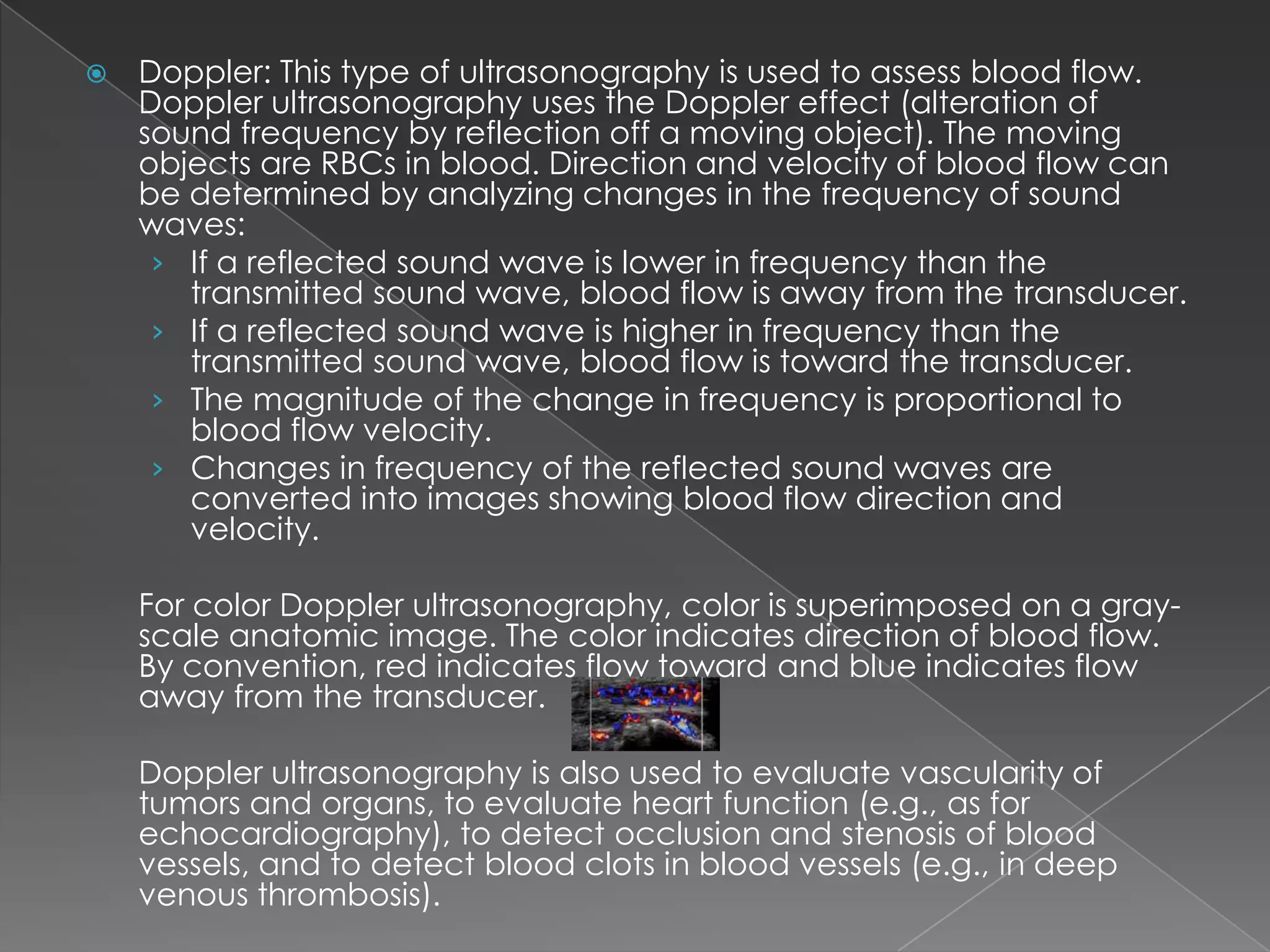 Ultrasonography | PPTX