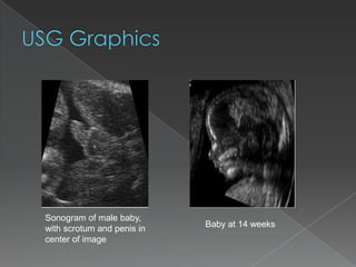 Ultrasonography | PPTX