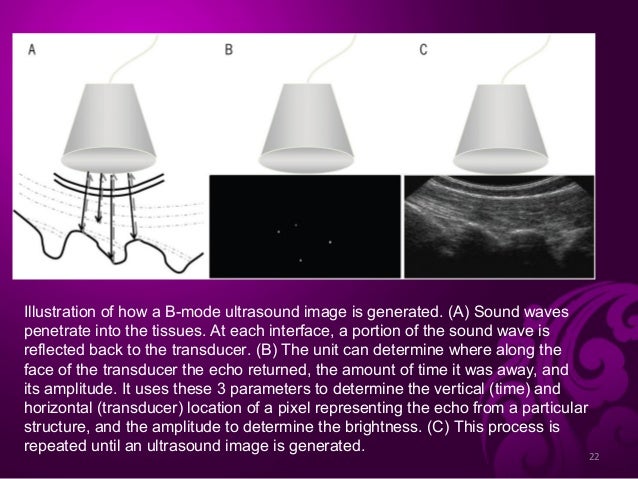 Rehabilitative Ultrasound Imaging: A musculoskeletal Perspective