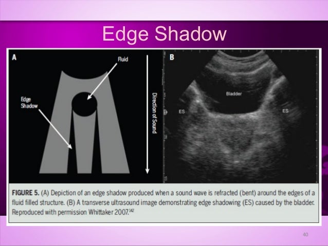 Rehabilitative Ultrasound Imaging: A musculoskeletal Perspective