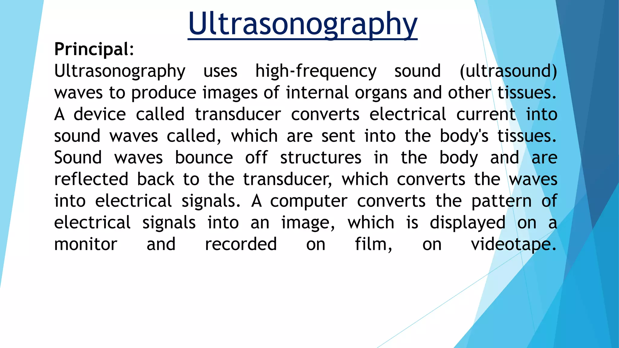 Ultrasonography | PPTX