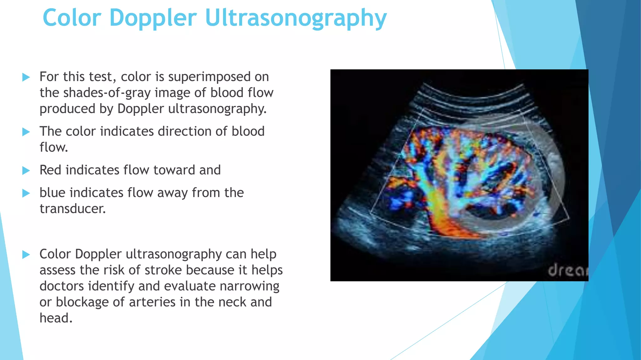 Ultrasonography | PPTX