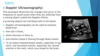 Ultrasonography | PPTX