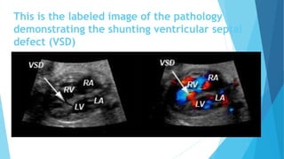 Ultrasonography | PPTX