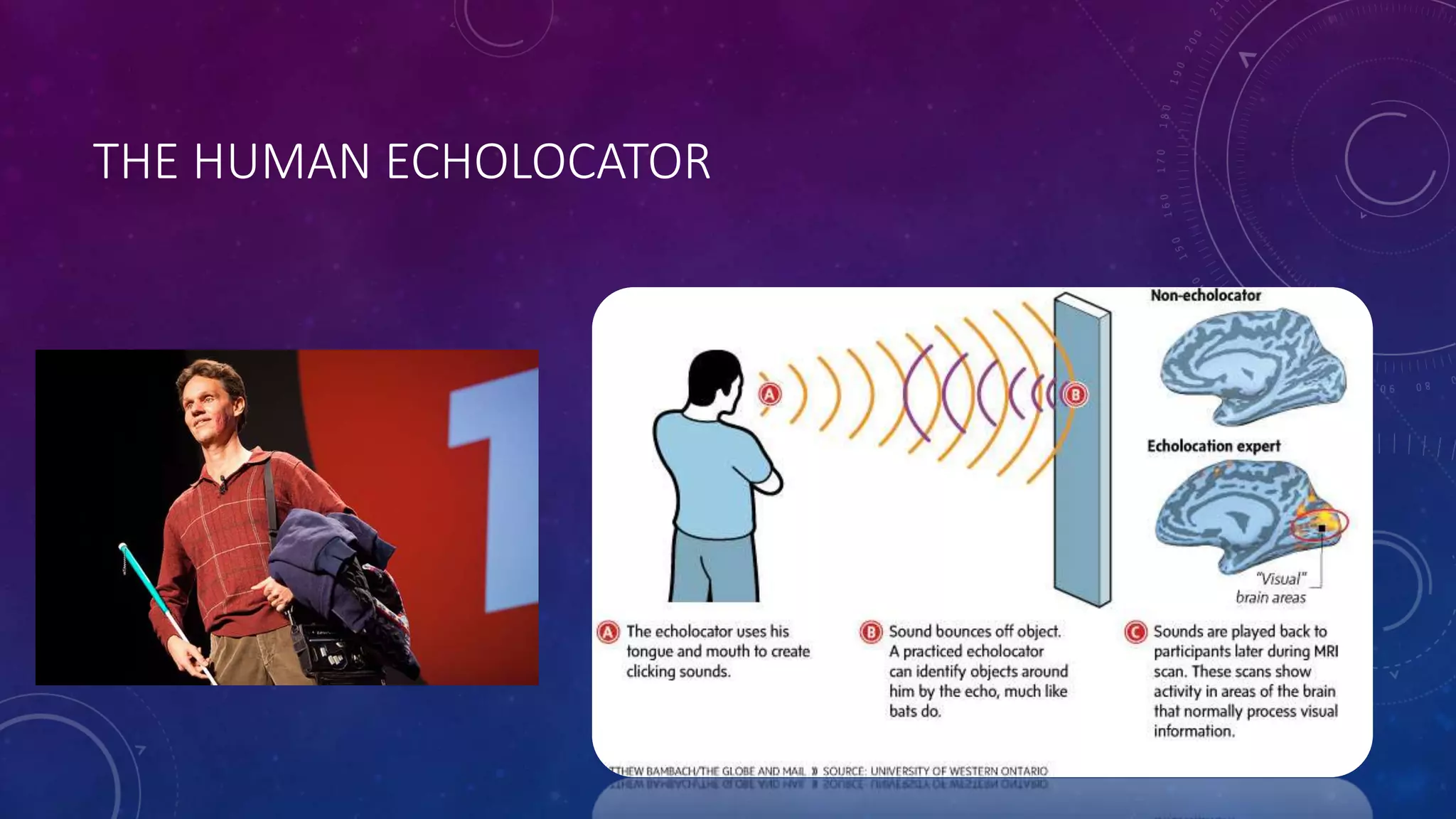 Ultrasonography - History, evolution and principles | PPTX