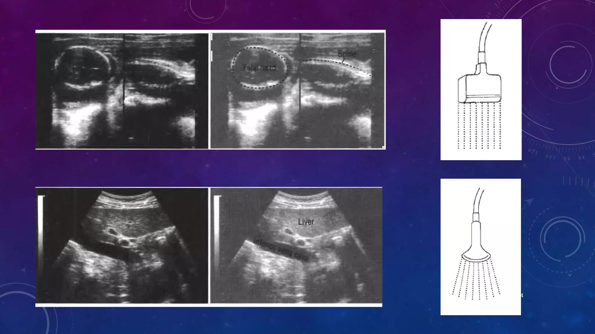 Ultrasonography - History, evolution and principles | PPTX